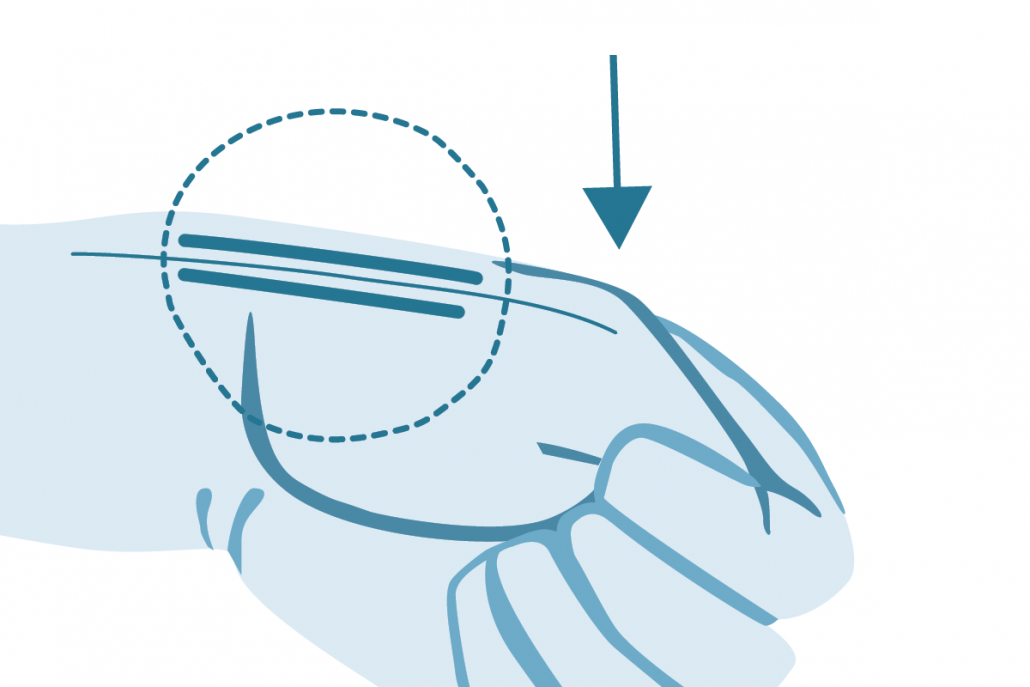 Handchirurgie – Dr. Marweh Schmitz